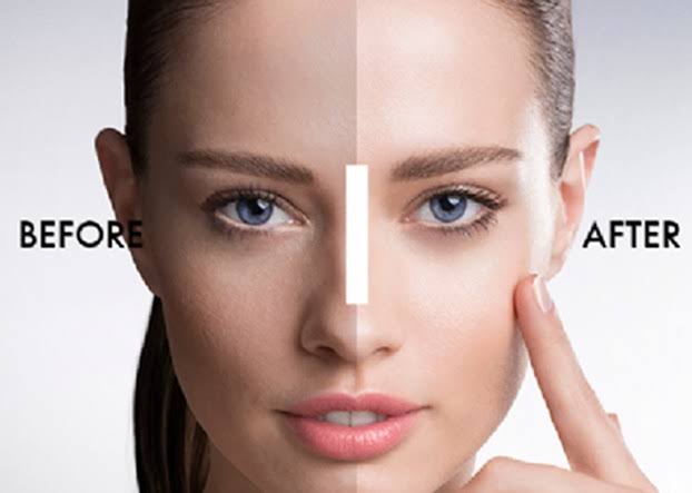 Cara Efektif Mengatasi Kulit Kusam Agar Tampak Lebih Segar | Jateng Live